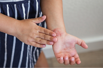 Protect your child from chemical burns