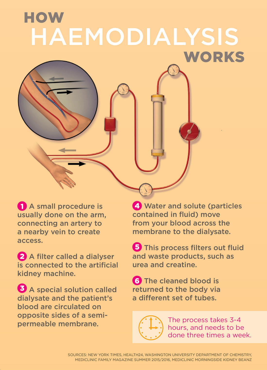 Dialysis Complete Information About Dialysis And Its Types Of Body